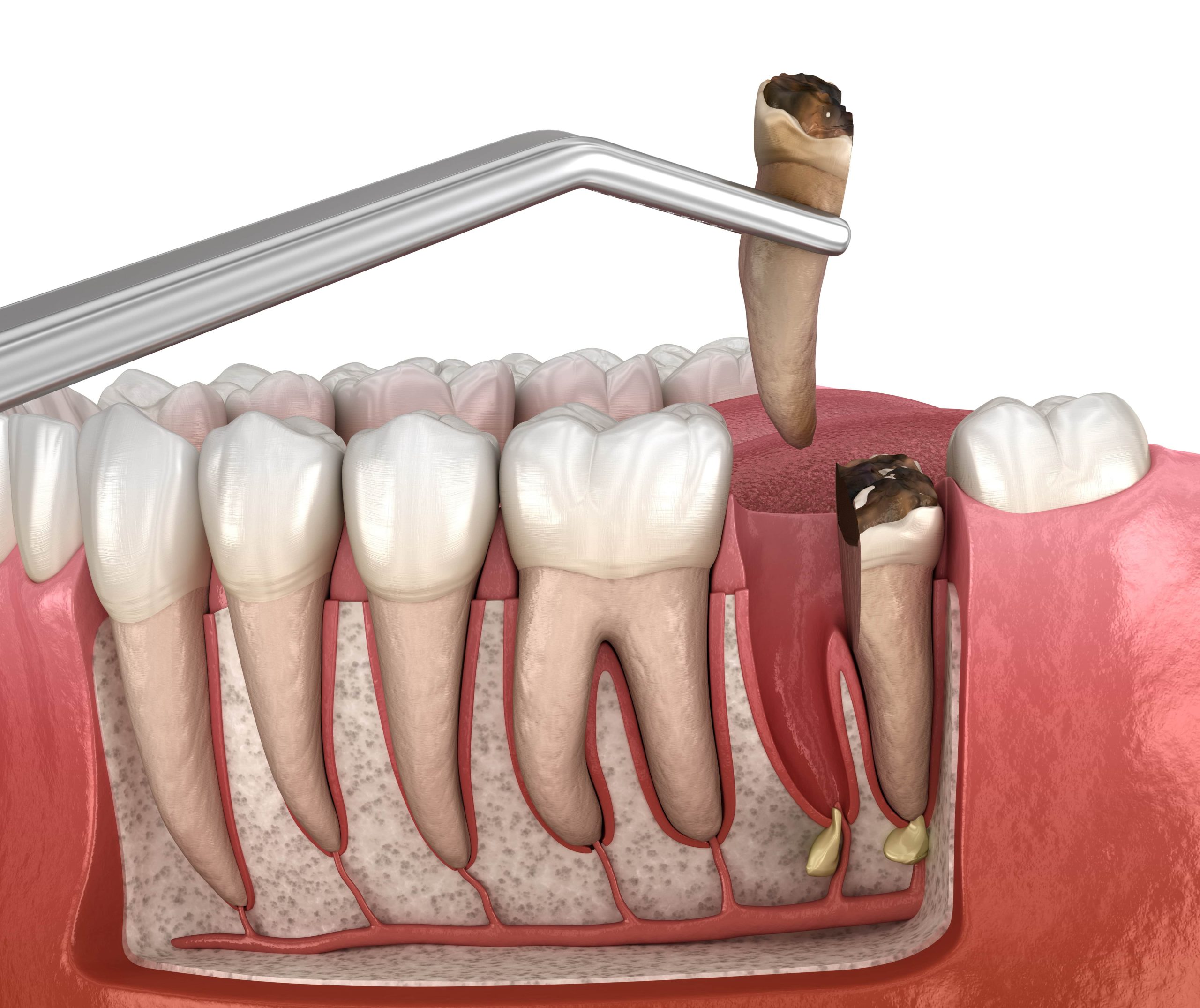 Surgical Periodontal Associates Of Memphis Surgical Periodontal Associates Of Memphis